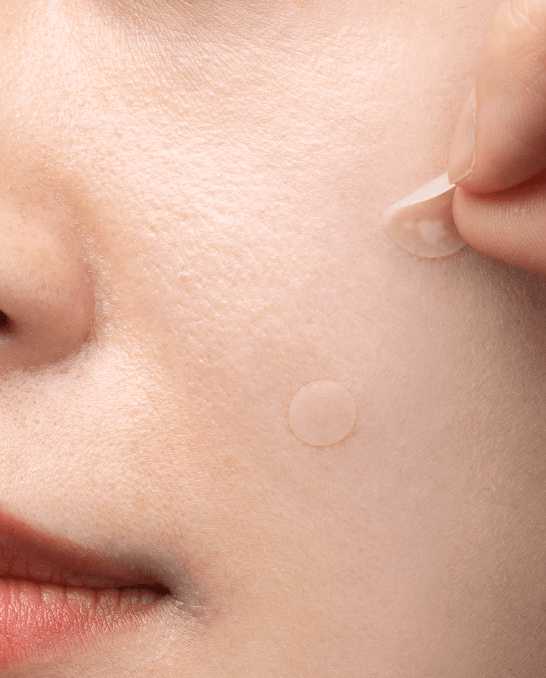 Surprise B Patch - Parche hidrocoloide para tratar acné y espinillas ...